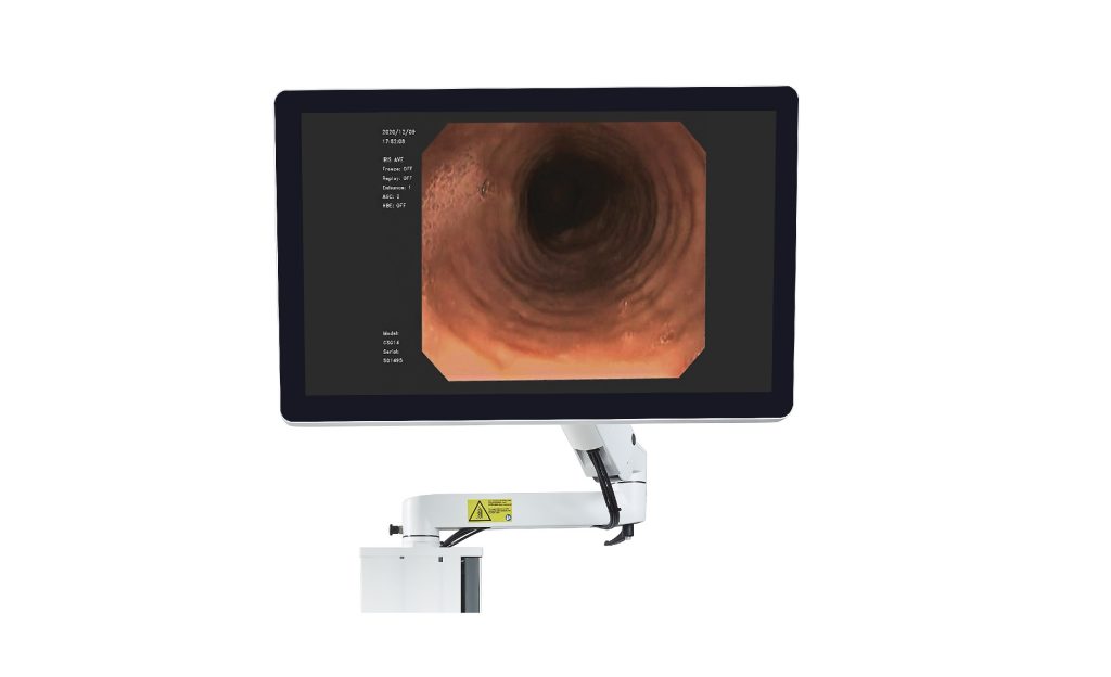 Medically Certified Monitors for Endoscopy